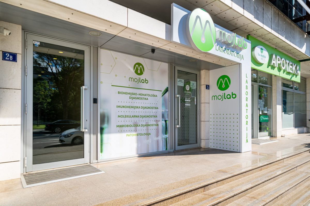 Moj Lab: Brzi testovi na COVID-19, rezultati već nakon par sati